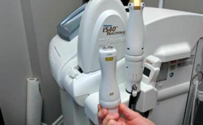 Лазерный пилинг на Palomar icon 1540